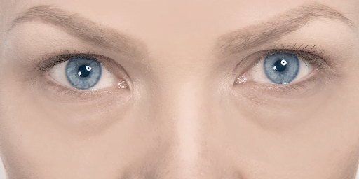 Why are There Specific Products for the Eye Contour Area? - Profvalue Blog